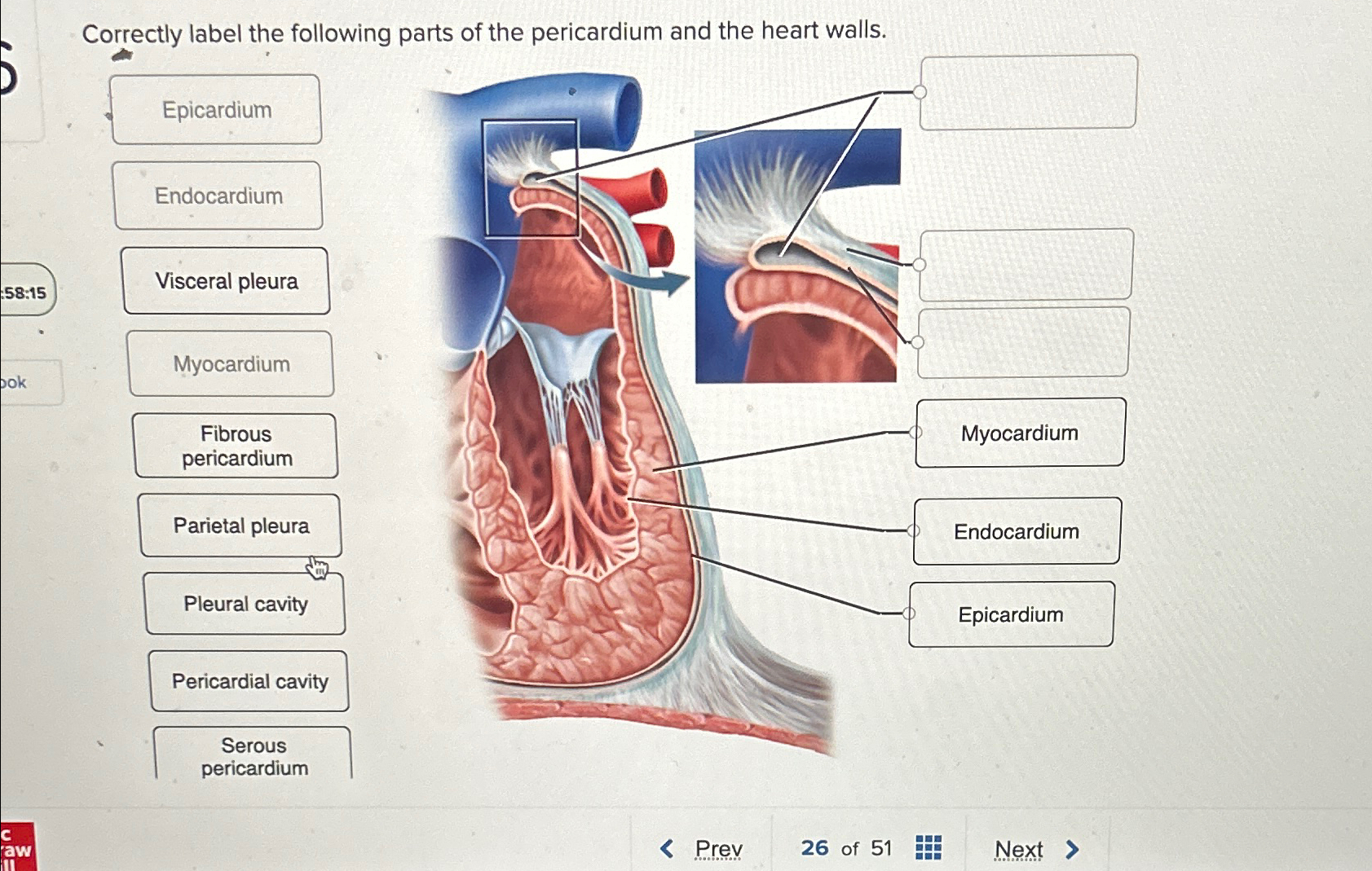 Solved Correctly label the following parts of the | Chegg.com
