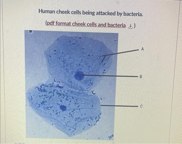 Solved When bacteria (label "A" above) attack your cells, | Chegg.com