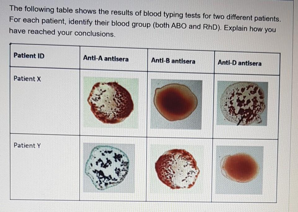 Solved The following table shows the results of blood typing | Chegg.com
