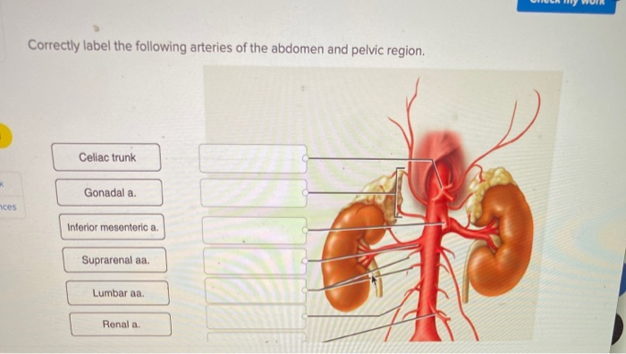 Solved Correctly label the following arteries of the abdomen | Chegg.com