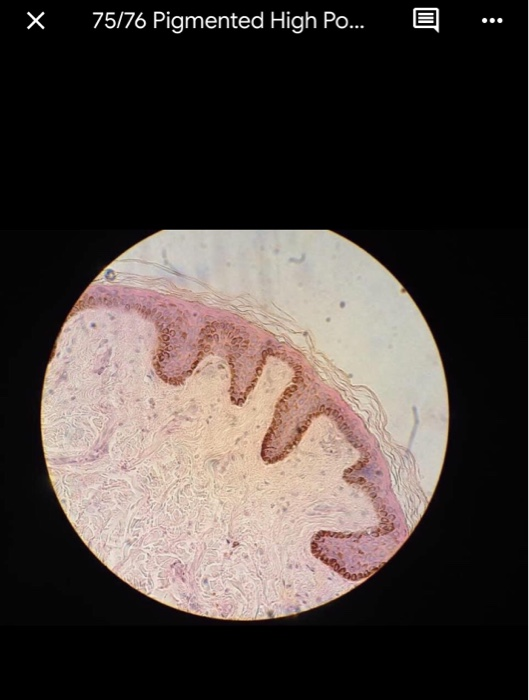 Dense Regular Connective (30) Draw a circle | Chegg.com