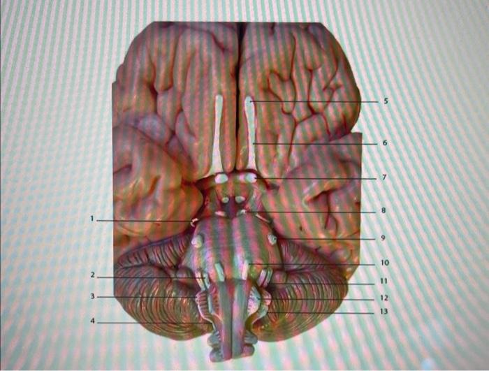 Solved PLEASE HELP ME LABEL 1-13 (cranial nerves of the | Chegg.com