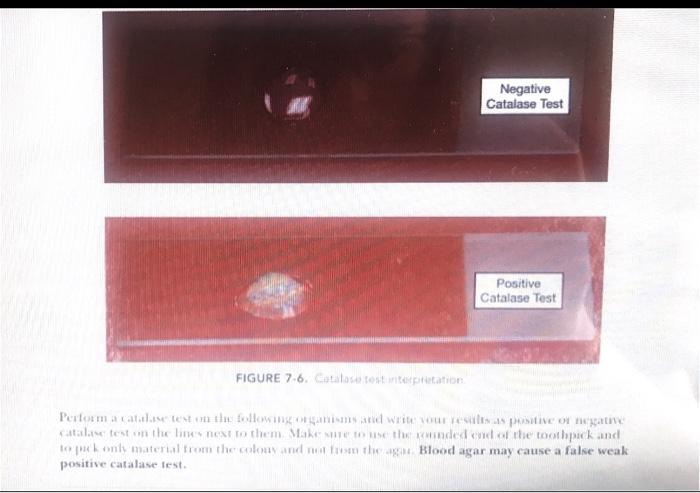 Solved The PYR (Pyrolidonyl Arylamidase) Test The PYR test | Chegg.com