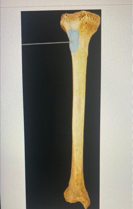 Solved 1. what is the highlighted bone?2. what is the | Chegg.com