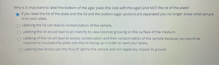 Solved Why is it important to label the bottom of the agar | Chegg.com