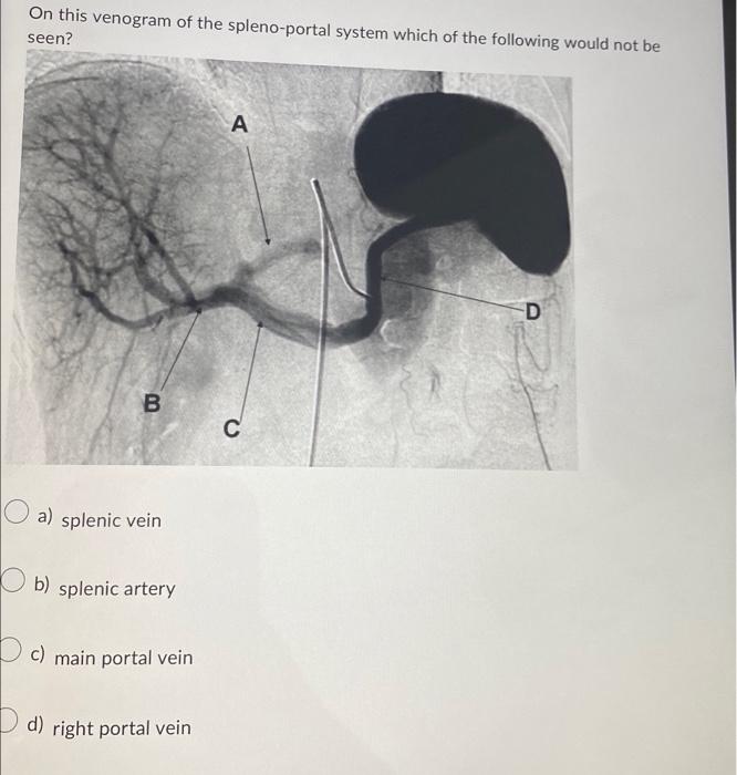 Solved please helpOn this venogram of the spleno-portal | Chegg.com