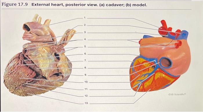 [Solved]: Figure 17.9 External heart, posterior view. (a) c
