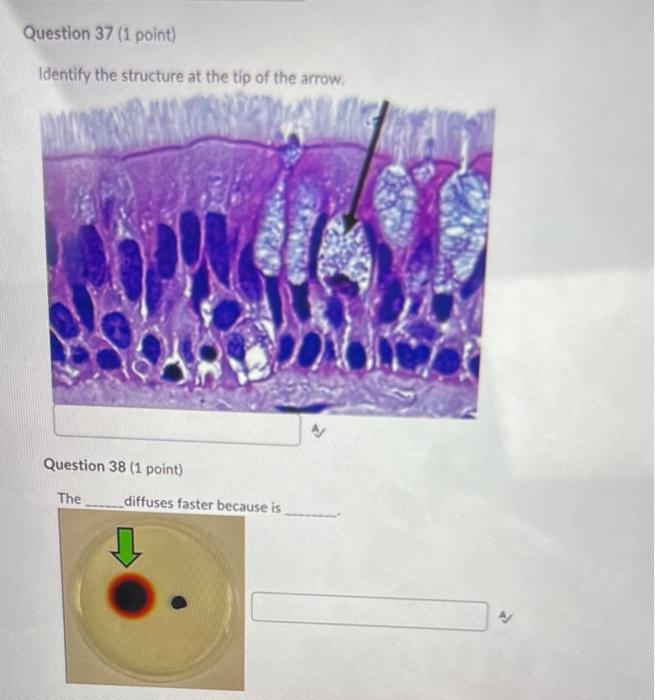Solved Idanbicu. the Identify the bone at the tip of the | Chegg.com