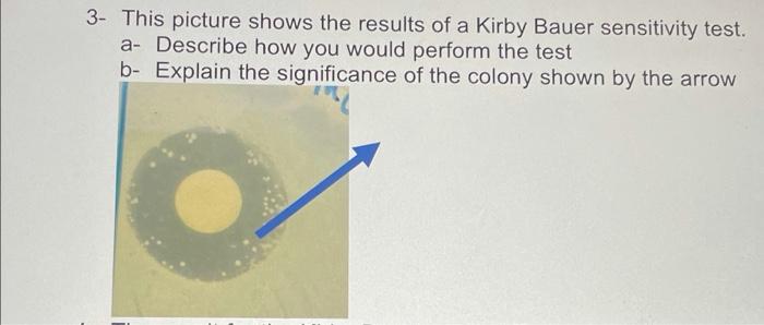 Solved 3- This picture shows the results of a Kirby Bauer | Chegg.com
