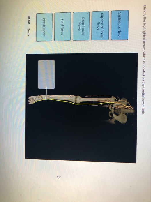 Solved Identify the highlighted nerve, which is located on | Chegg.com