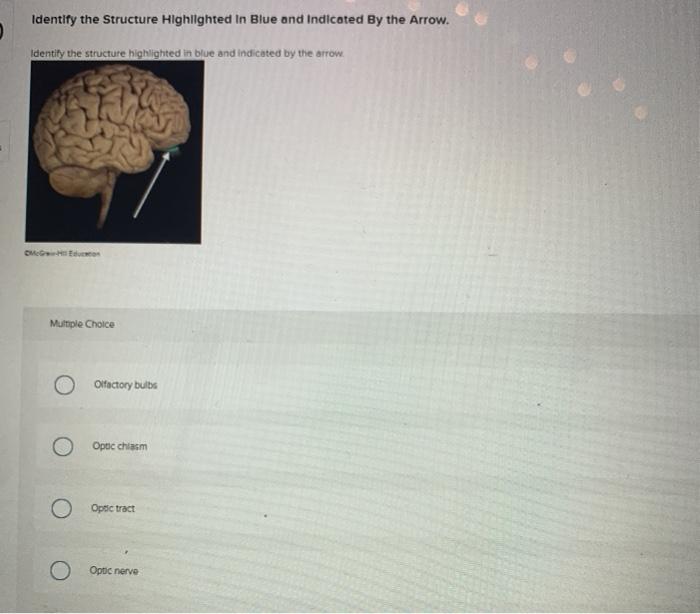 Solved Identify the Structure Highlighted In Blue and | Chegg.com