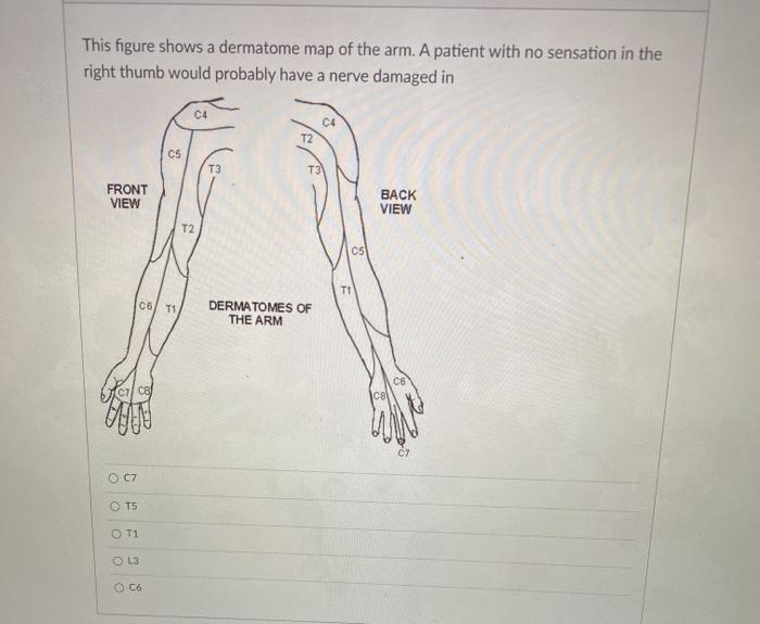 Solved This figure shows a dermatome map of the arm. A | Chegg.com