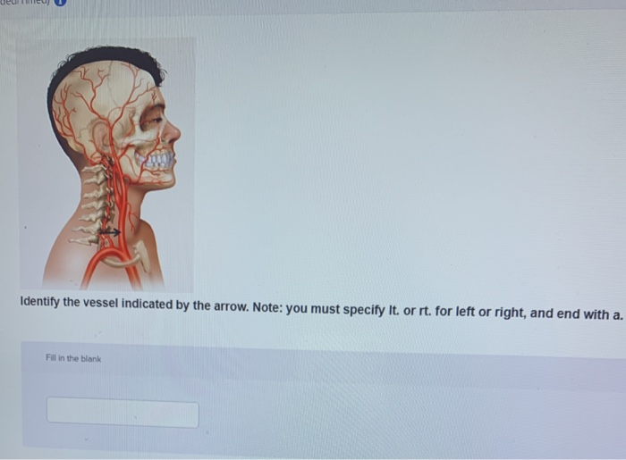 Solved Identify the vessel indicated by the arrow. Note: you | Chegg.com