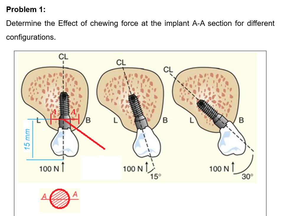 Solved Problem 1:Determine the Effect of chewing force at | Chegg.com