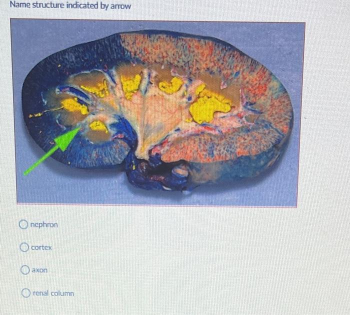 Solved Name structure indicated by arrow nephron O cortek | Chegg.com