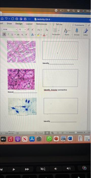 Lab Activity Chapter 4 Identify the tissues in the | Chegg.com