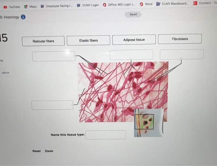 Solved 3 Identifying Epithelium: Epidermis of the Sole of | Chegg.com