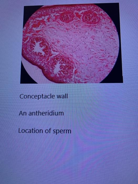 Solved Conceptacle wall An antheridium Location of sperm | Chegg.com