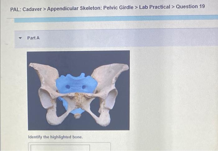 Solved PAL: Cadaver > Appendicular Skeleton: Pelvic Girdle > | Chegg.com