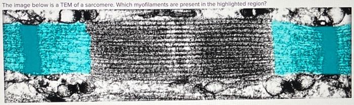 Solved Multiple Choice Thick filaments only Thin filaments | Chegg.com