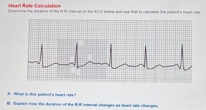 Solved Heart Rate Calculation Determine the duration of the | Chegg.com