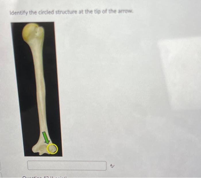 Solved Identify the circled structure at the tip of the | Chegg.com
