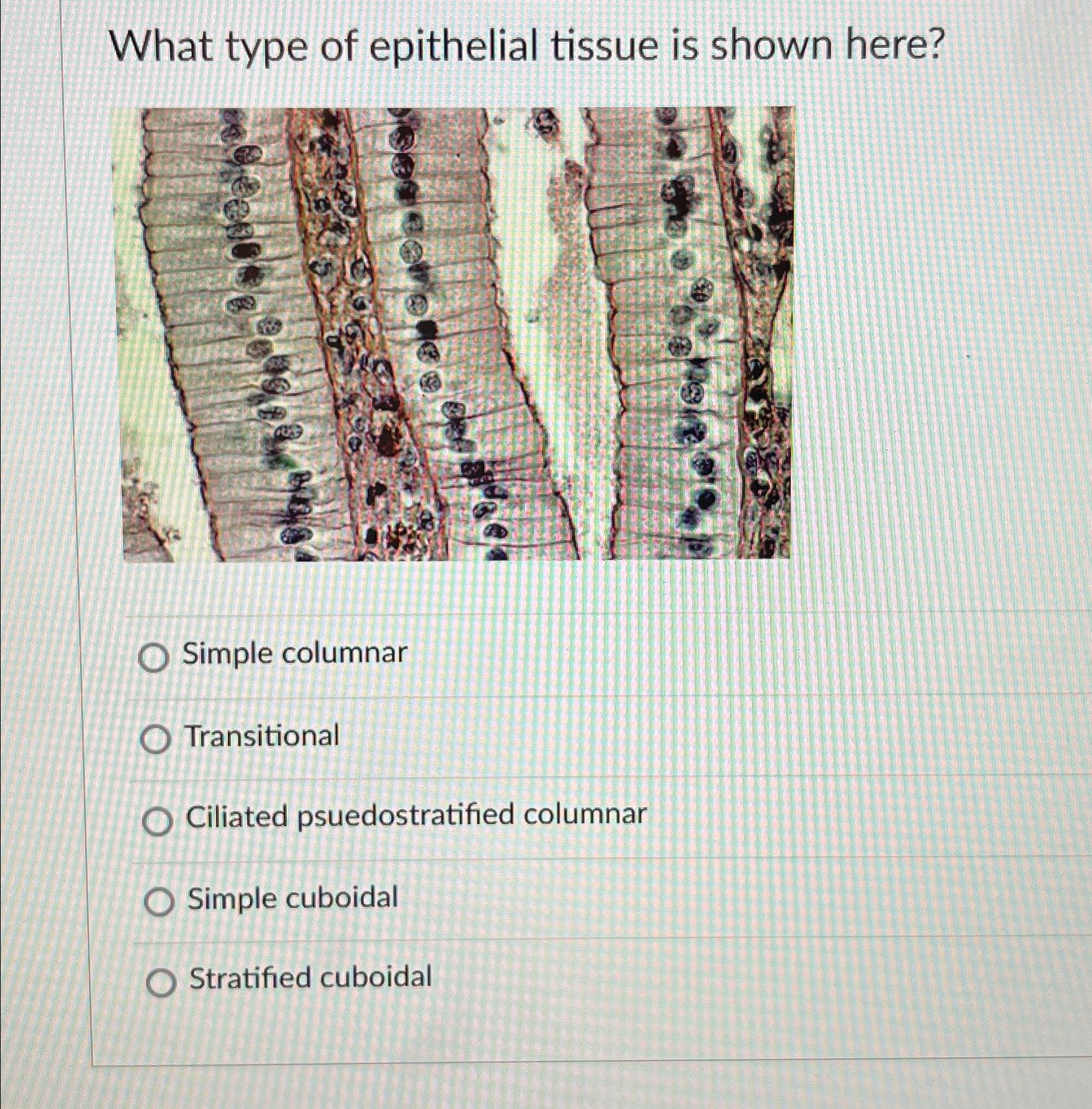 Solved What type of epithelial tissue is shown here?Simple | Chegg.com