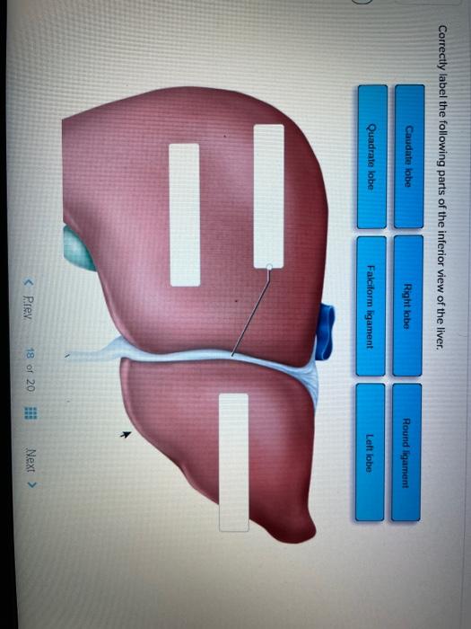Solved Correctly label the following parts of the inferior | Chegg.com