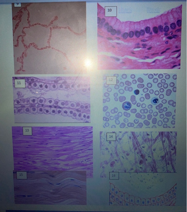 Solved Identifying Tissues: Use the following key to help | Chegg.com