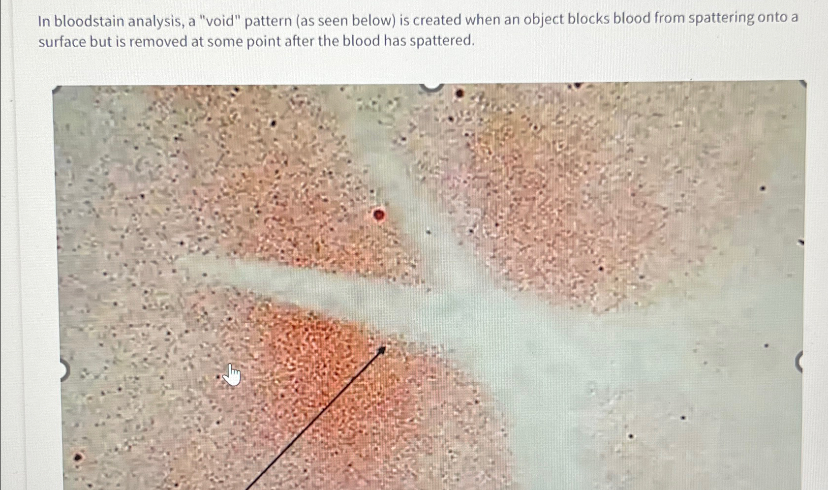 Solved In bloodstain analysis, a "void" pattern (as seen | Chegg.com