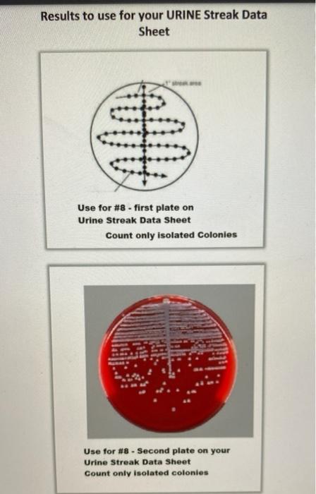 Solved Urine Culture 6-3 OBSERVATIONS AND INTERPRETATIONS 1 | Chegg.com