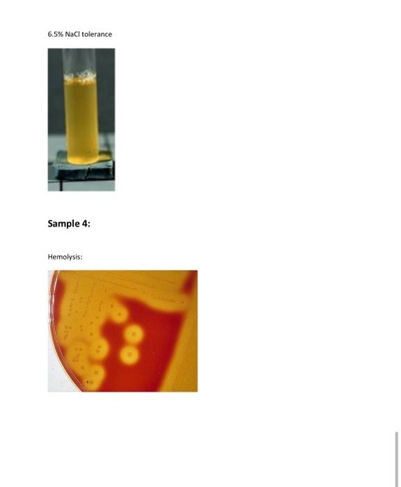 Solved The following are the results after incubation of | Chegg.com