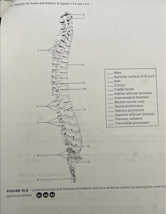 Solved 2. Identify the bones and features in figures 15.8 | Chegg.com