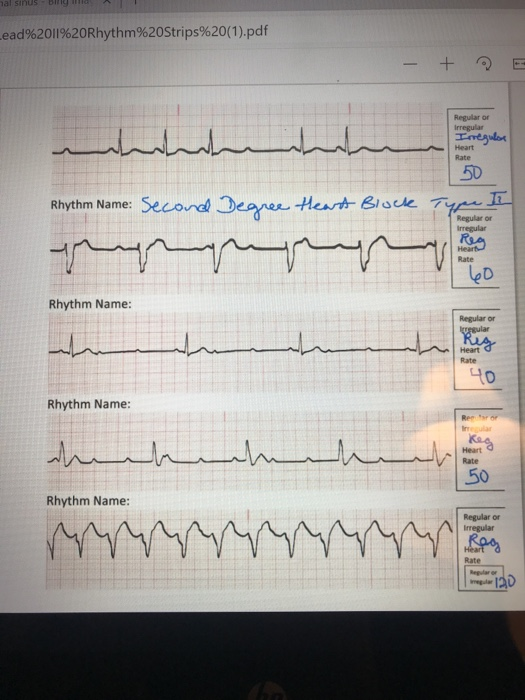 Second Degr Second Degr