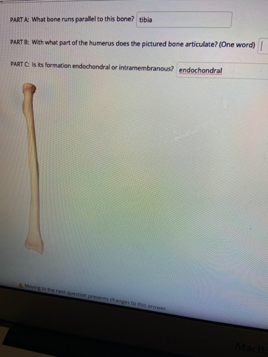 Solved PART A: What bone runs parallel to this bone? tibia | Chegg.com