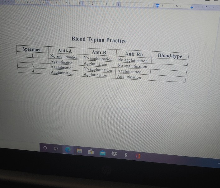 Solved 1 2 3 !!! Blood Typing Practice Specimen Blood type | Chegg.com