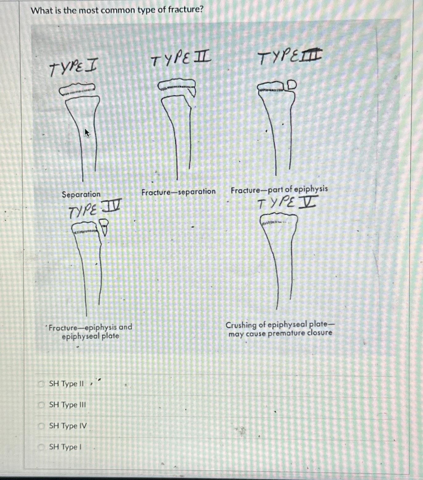 Solved What is the most common type of | Chegg.com