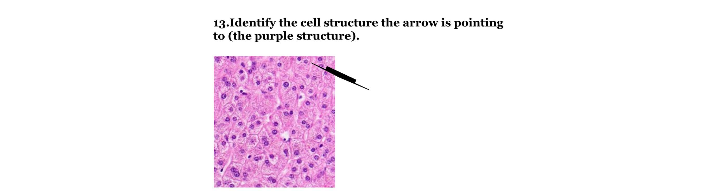 Solved 13.Identify the cell structure the arrow is pointing | Chegg.com