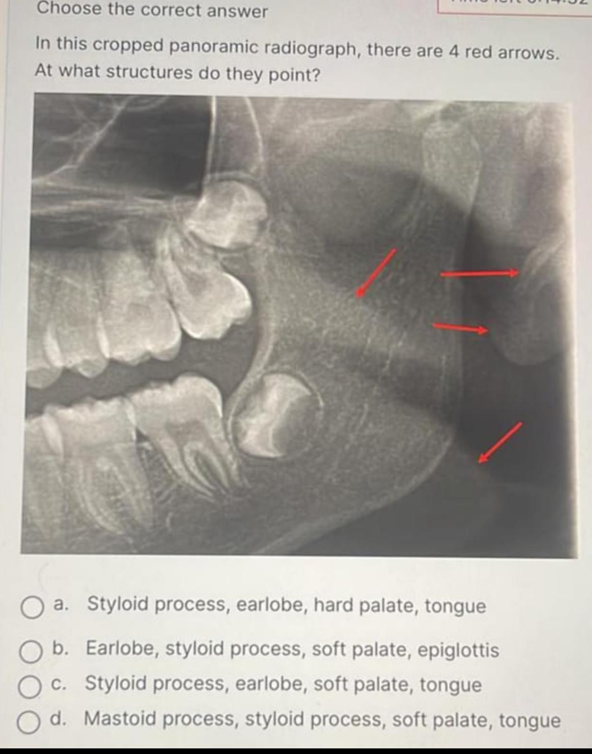 Solved Choose the correct answerIn this cropped panoramic | Chegg.com