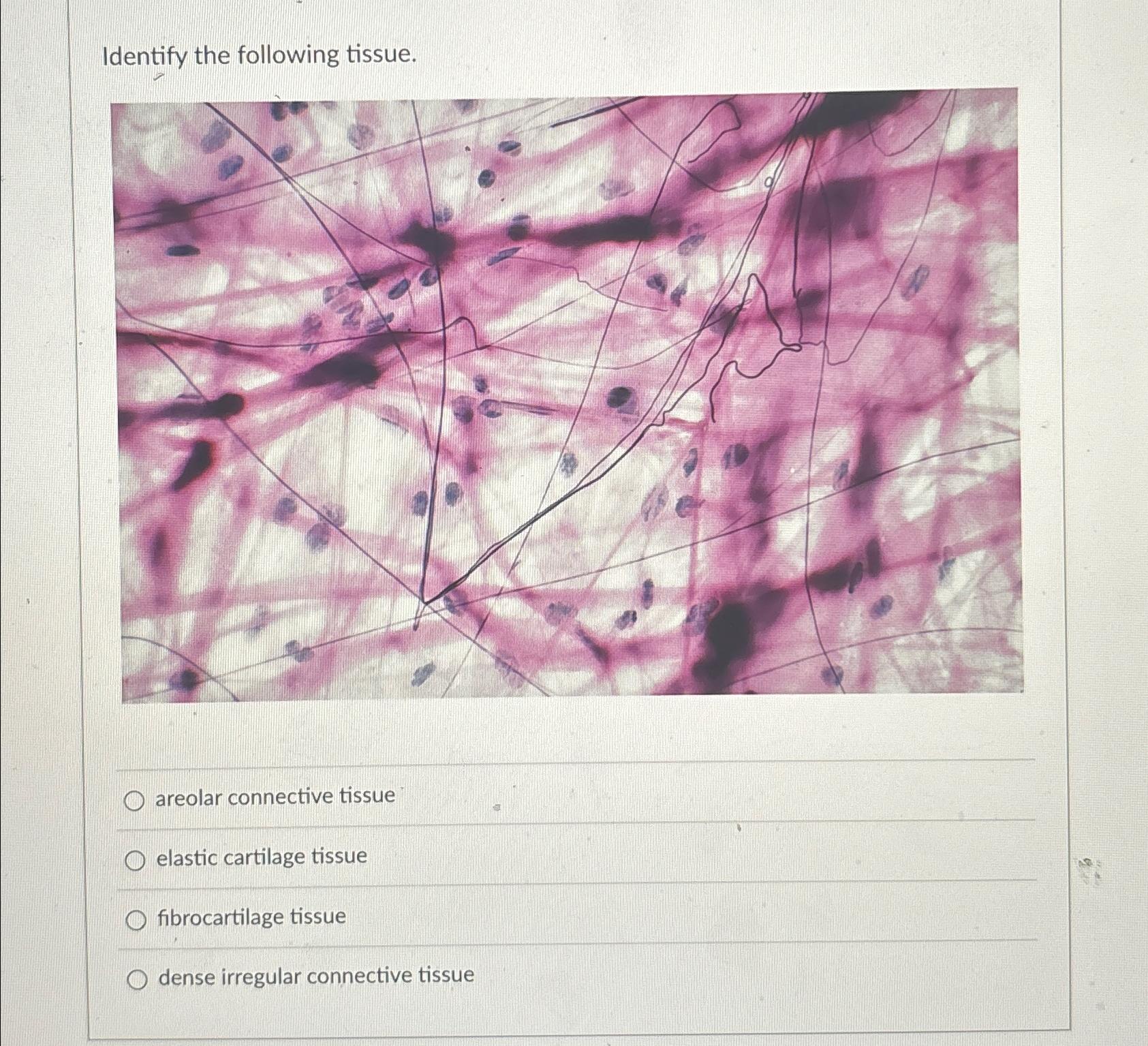 Solved Identify the following tissue.areolar connective | Chegg.com Solved Identify the following tissue.areolar connective | Chegg.com