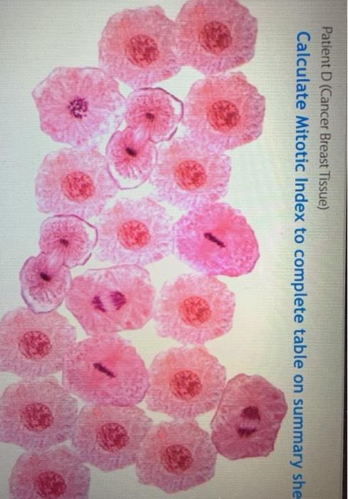 Solved 1. Looking at the mitotic index for all 3 cancer | Chegg.com