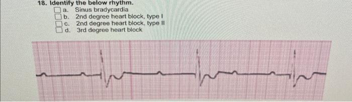 Solved 18. Identify the below rhythm. a. Sinus bradycardia | Chegg.com