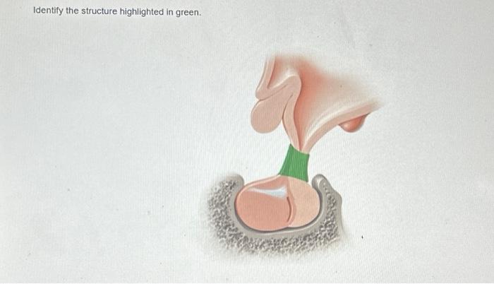 Solved Identify the structure highlighted in | Chegg.com