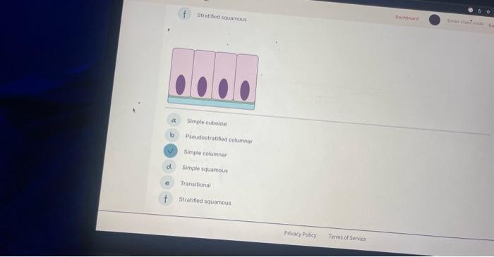Solved a Simple cuboida! b Pseudostratified columnar c | Chegg.com