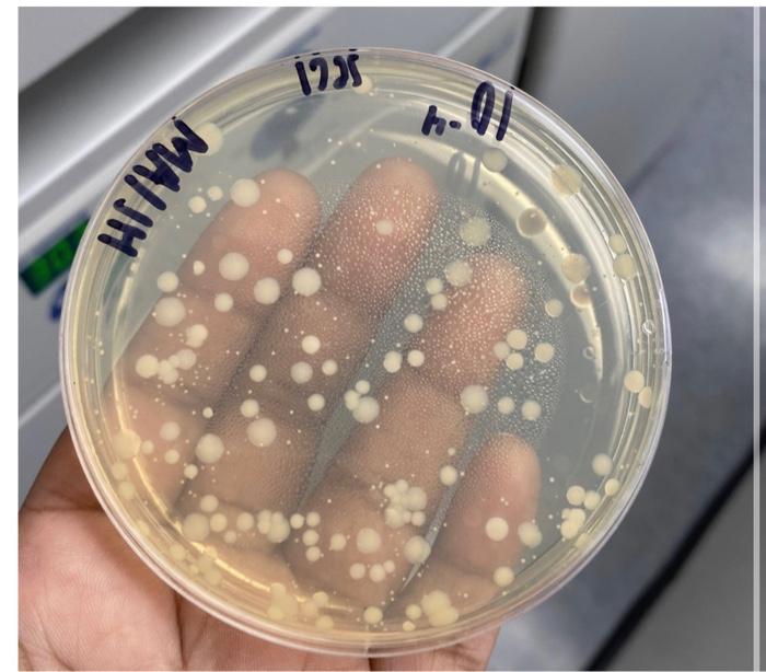 Solved count the colonies and calculate the number of | Chegg.com
