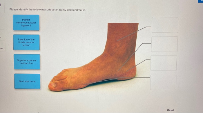 Solved Please identify the following surface anatomy and | Chegg.com