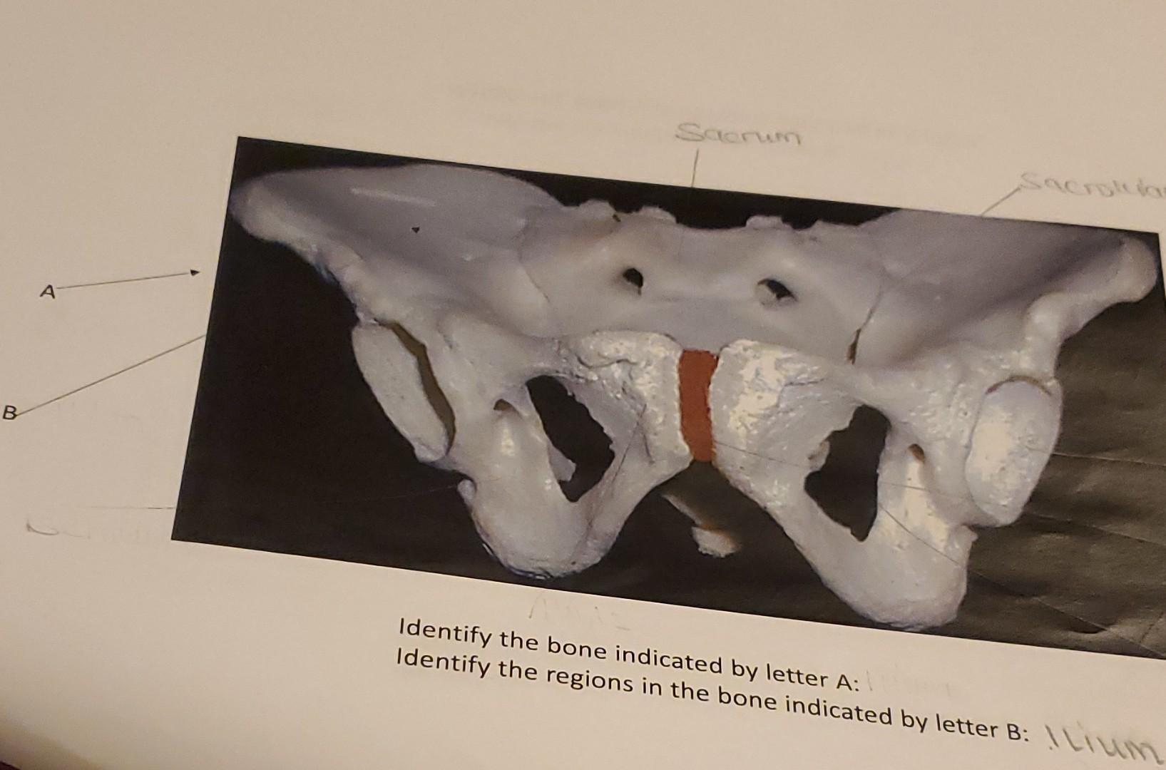 Solved Identify the bone indicated by letter A : Identify | Chegg.com