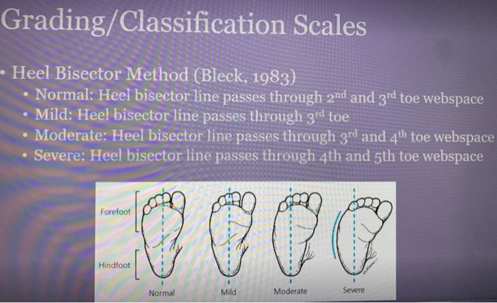 Solved Metatarsus Adductus and Abductus Lecture (3 points) | Chegg.com