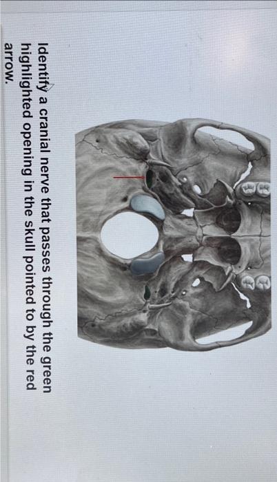Solved Identify a cranial nerve that passes through the | Chegg.com