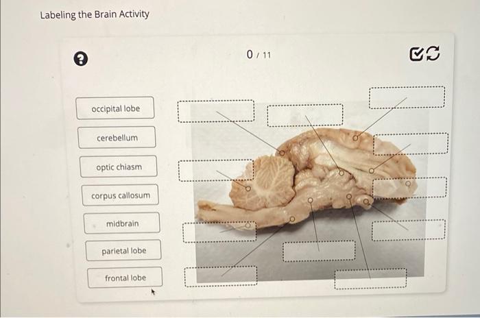 Solved Labeling the Brain Activity | Chegg.com